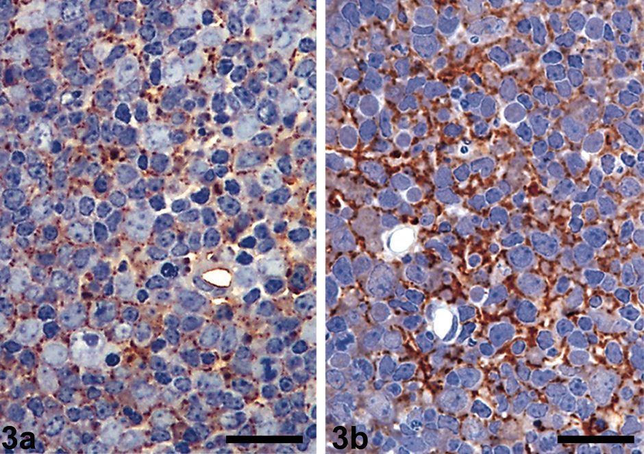 Prions: Diseases and Treatment - Serious Science